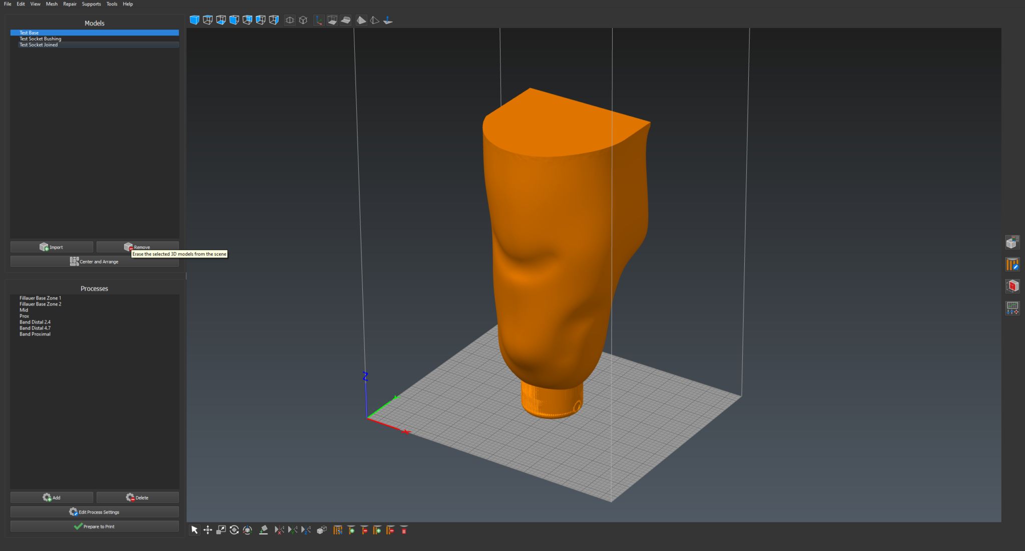 Custom Slice File-Transtibial/KneeDisarticulation | 3D O&P