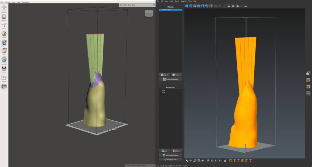 Custom Slice and Modify Transtibial with Fillauer Pyramid Lock | 3D O&P